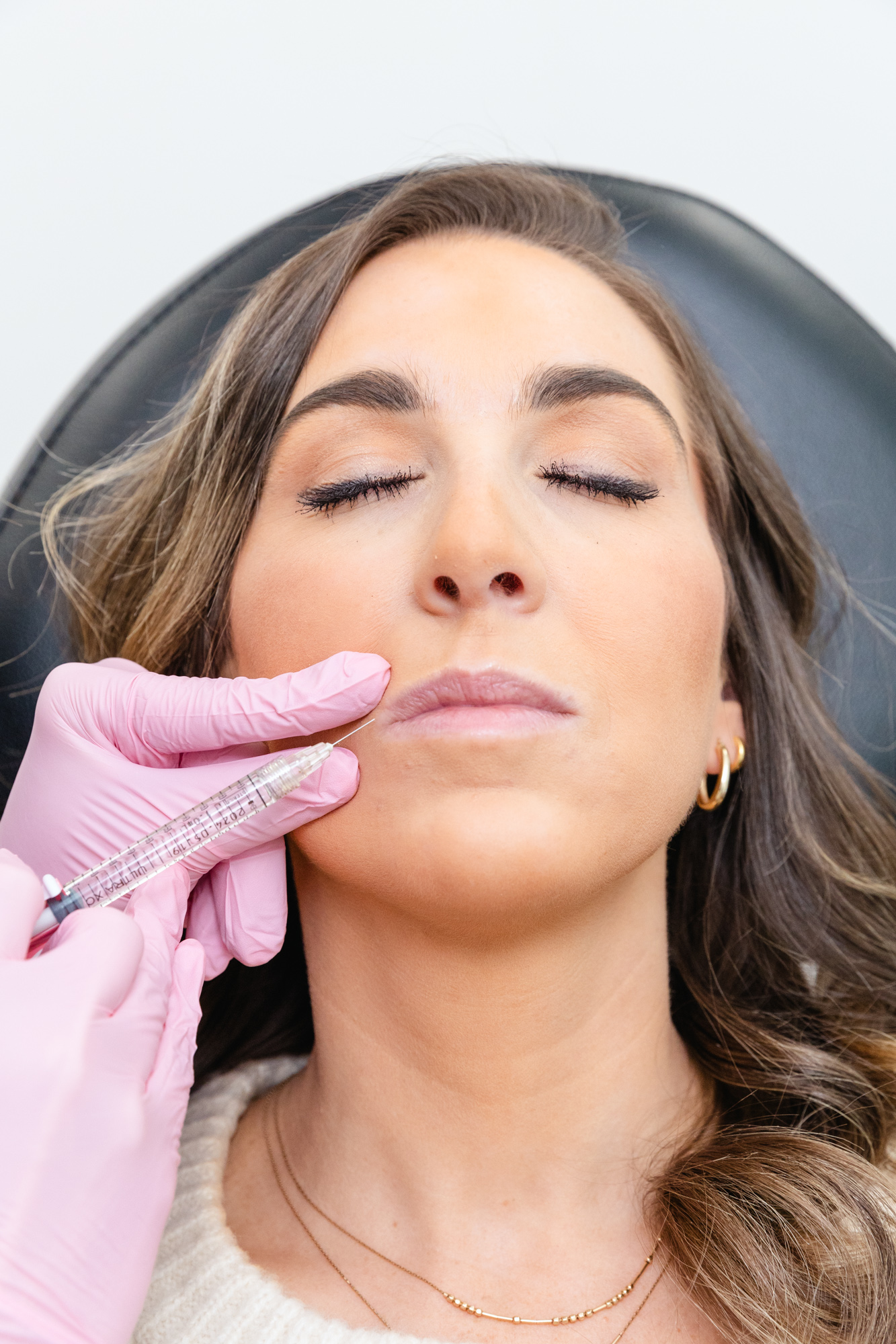 Filler in Oak Ridge | Shea Aesthetic Clinic