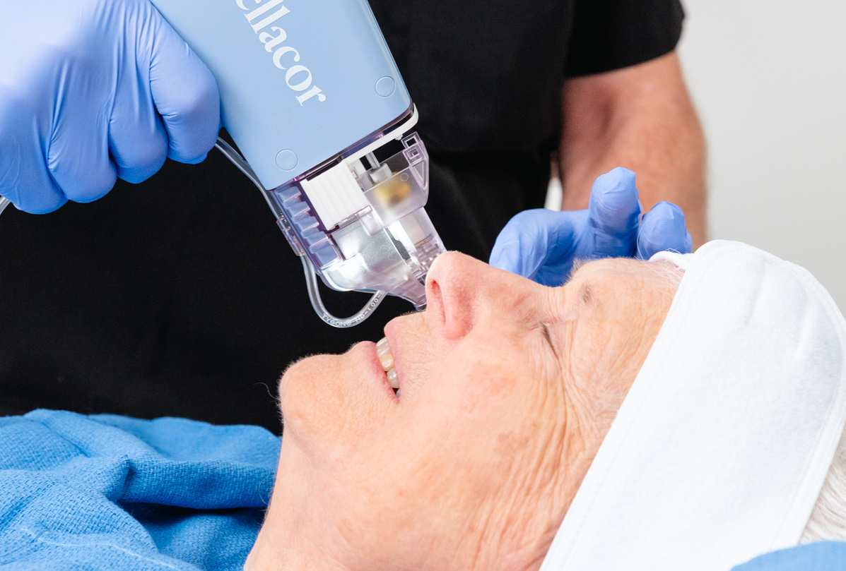 Ellacor in Oak Ridge | Shea Aesthetic Clinic
